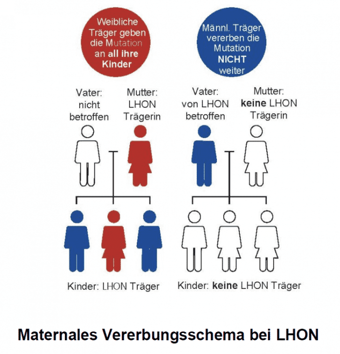 Lebersche Hereditäre Optikus-Neuropathie (LHON) | ApothekenWiki